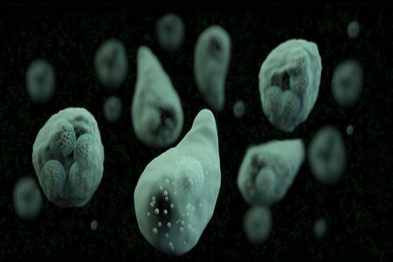 Amoebiasis: definition, symptoms and diagnosis - آزمایشگاه تشخیص طبی و ...