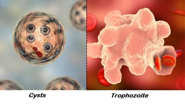 Amoebiasis: definition, symptoms and diagnosis - آزمایشگاه تشخیص طبی و ...